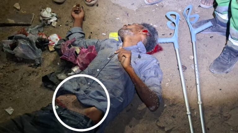 Al-Shati Camp Massacre: Starving Civilians Targeted Again - Gaza Herald